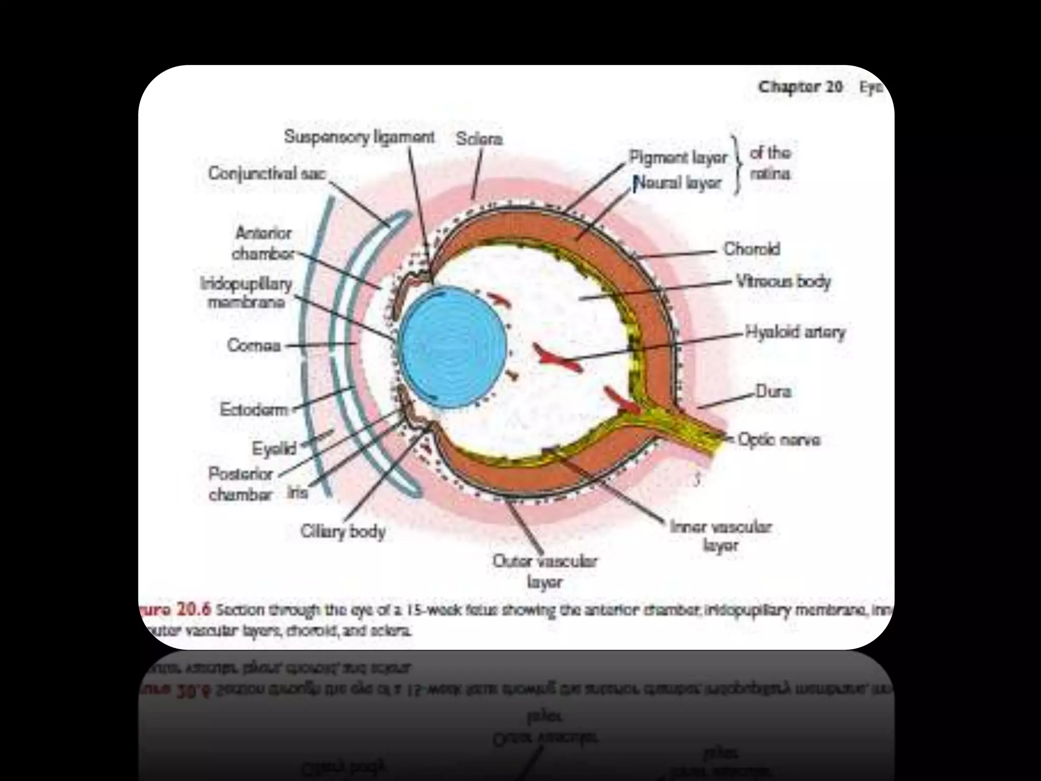 Corpus vitreum and optical nerve by syifadhila | PPTX