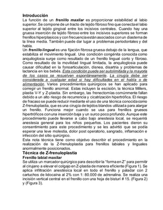 CORRECCION DE FRENILLOS LINGUALES Y LABIALES CORTOS CON Z ...
