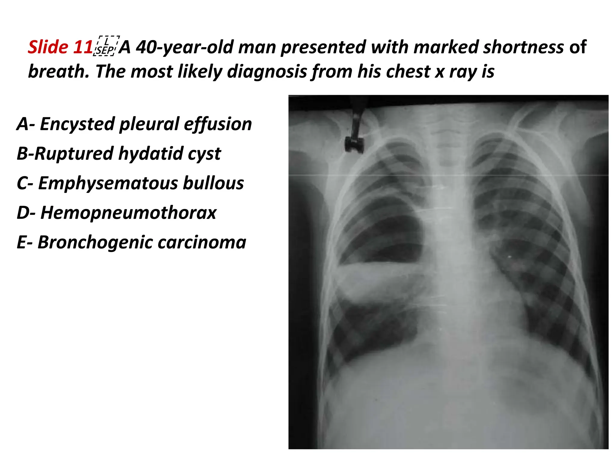 Corrected-slide-exam-for-6th-year-in_2.ppt