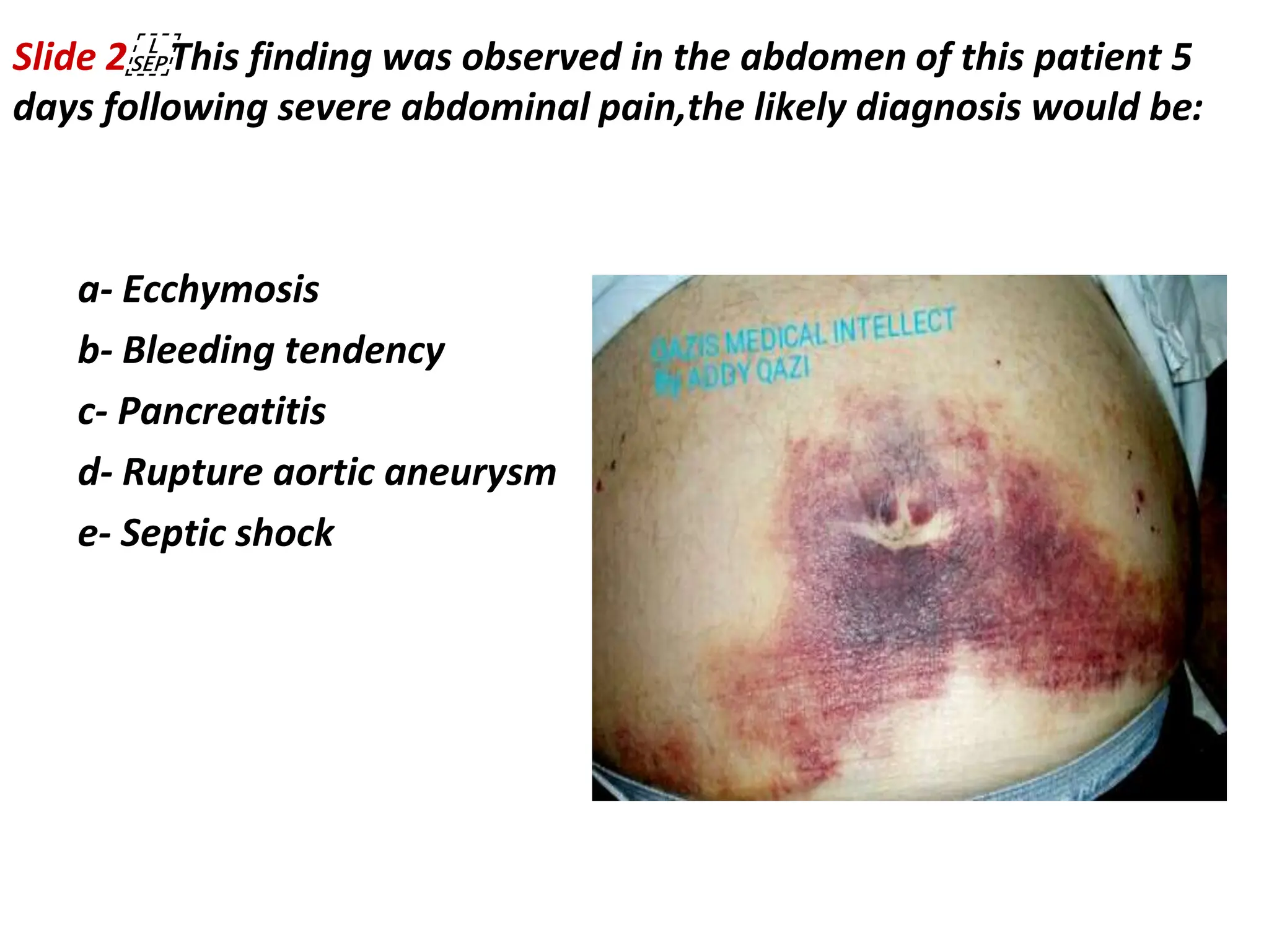 Corrected-slide-exam-for-6th-year-in_2.ppt