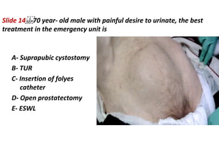 Corrected-slide-exam-for-6th-year-in_2.ppt