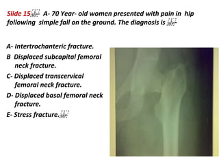 Corrected-slide-exam-for-6th-year-in_2.ppt