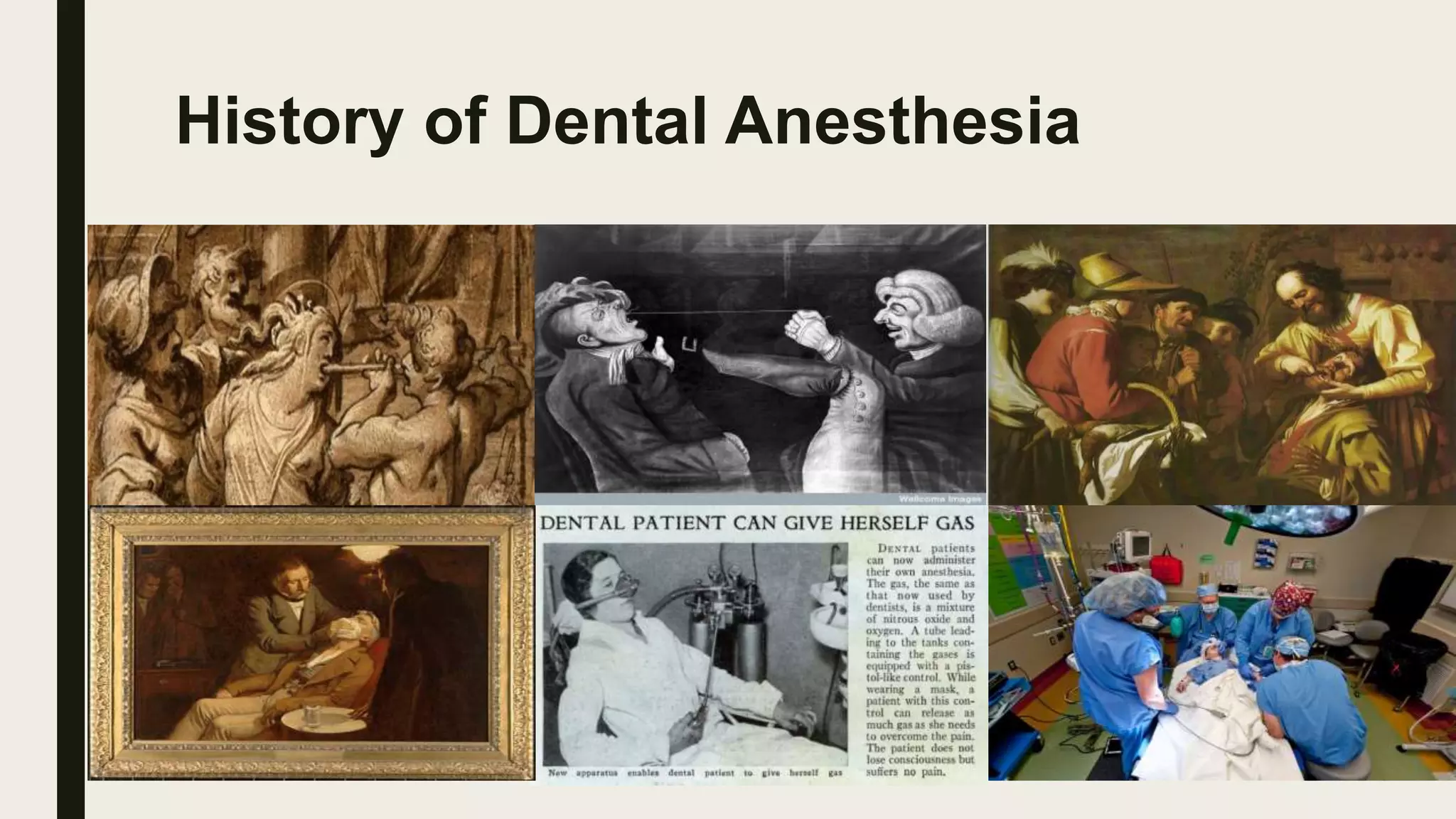 Anesthesia For Dental surgery | PPTX