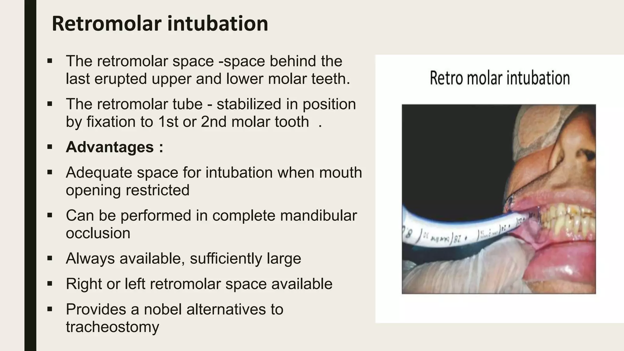 Anesthesia For Dental surgery | PPTX