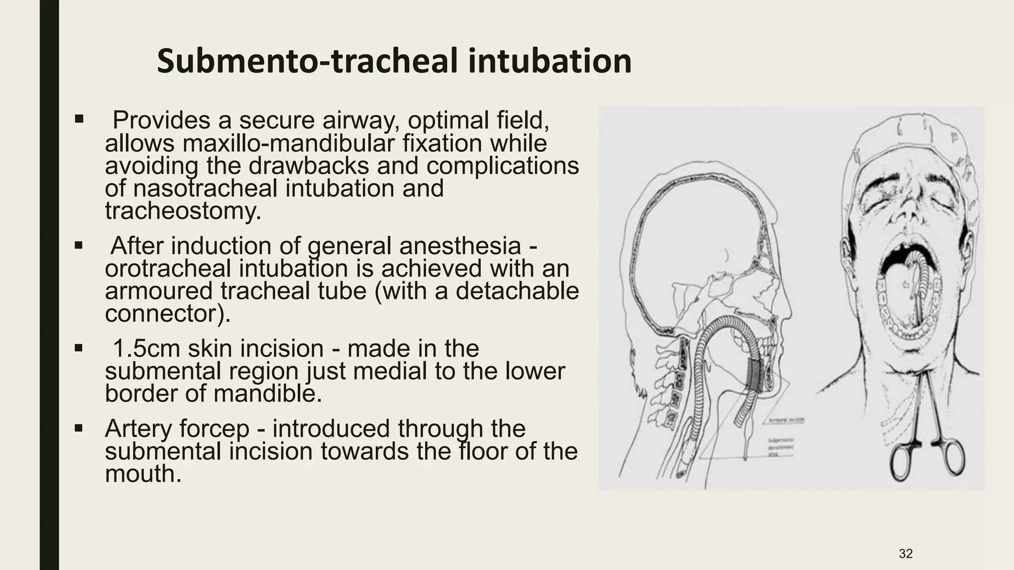 Anesthesia For Dental surgery | PPTX