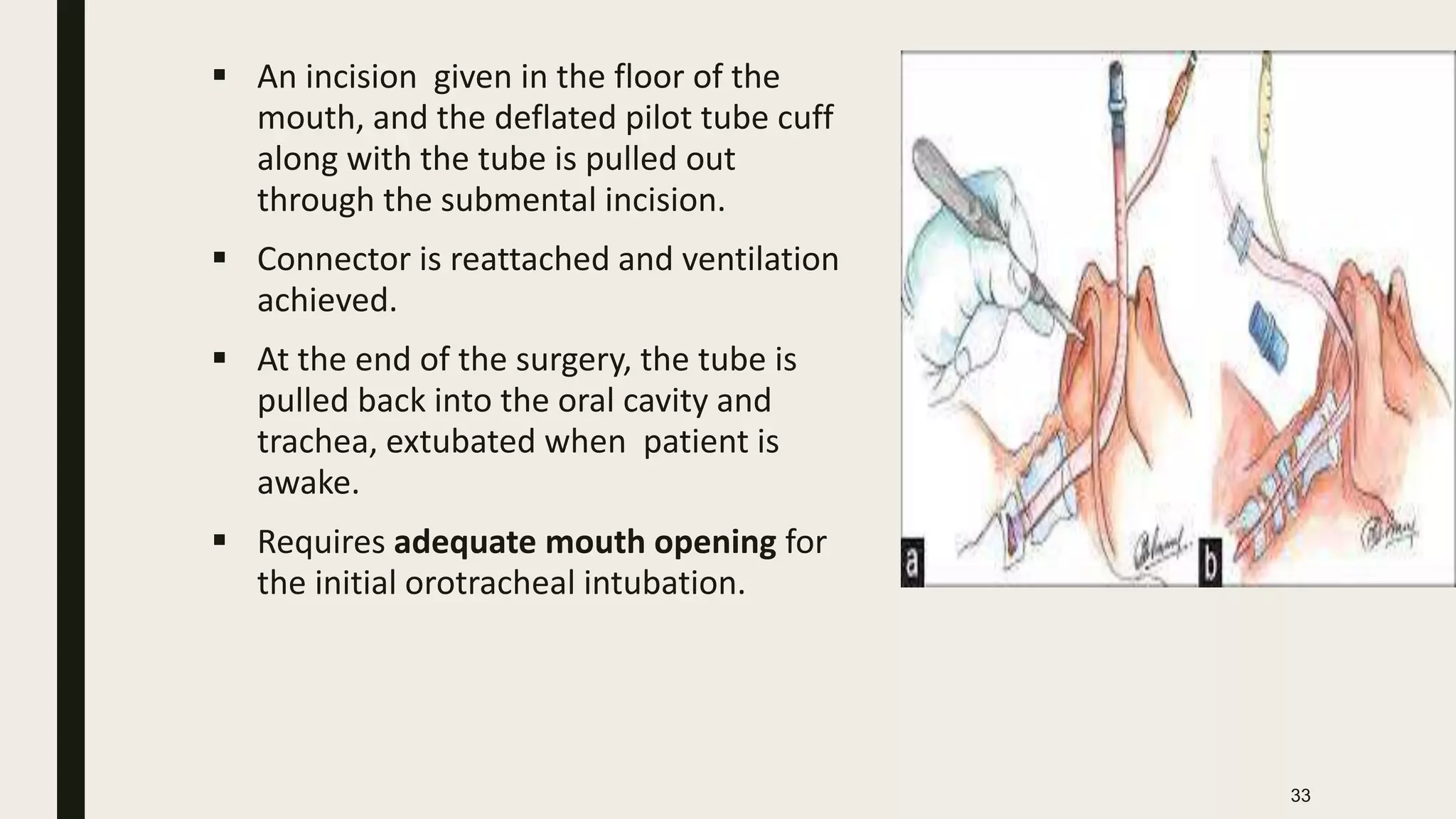 Anesthesia For Dental surgery | PPTX
