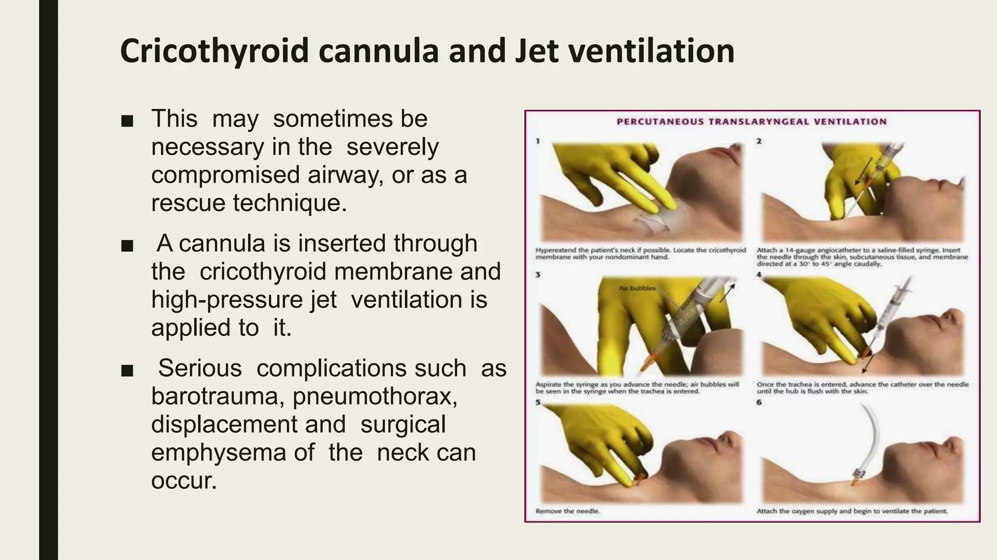 Anesthesia For Dental surgery | PPTX