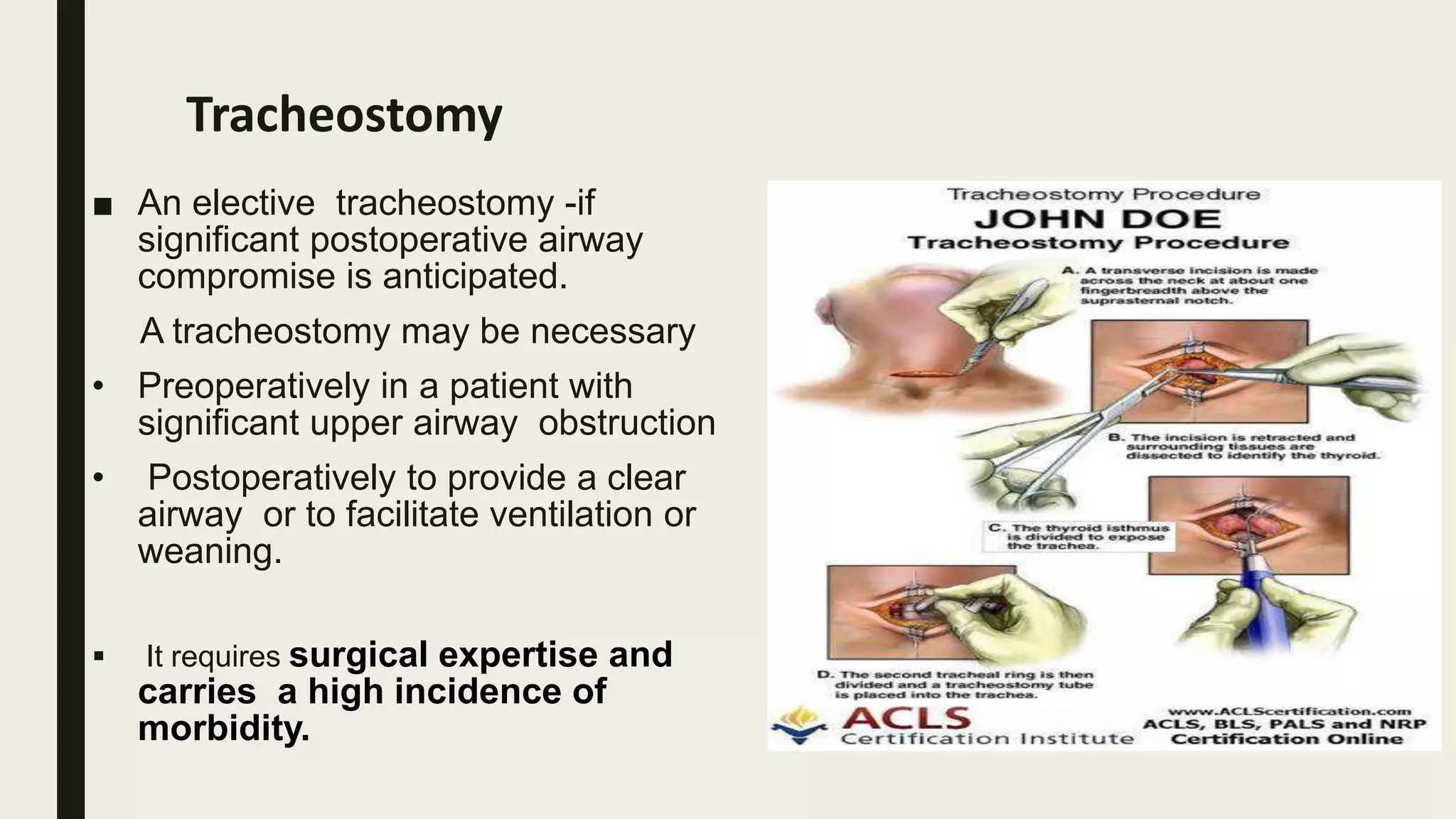 Anesthesia For Dental surgery | PPTX