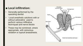 Anesthesia For Dental surgery | PPTX