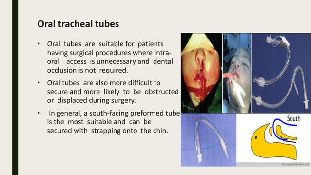 Anesthesia For Dental surgery | PPTX | Ear, Nose and Throat Conditions ...