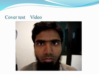 traumatic abducent nerve palsy | PPTX