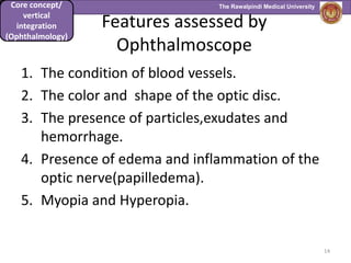 corrected version of Ophthalmoscopy by proffessor Samia..pptx