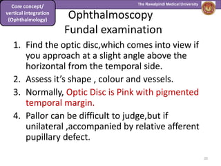 corrected version of Ophthalmoscopy by proffessor Samia..pptx