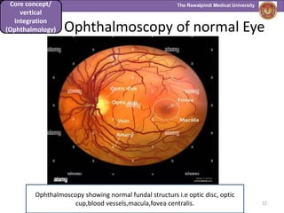 corrected version of Ophthalmoscopy by proffessor Samia..pptx