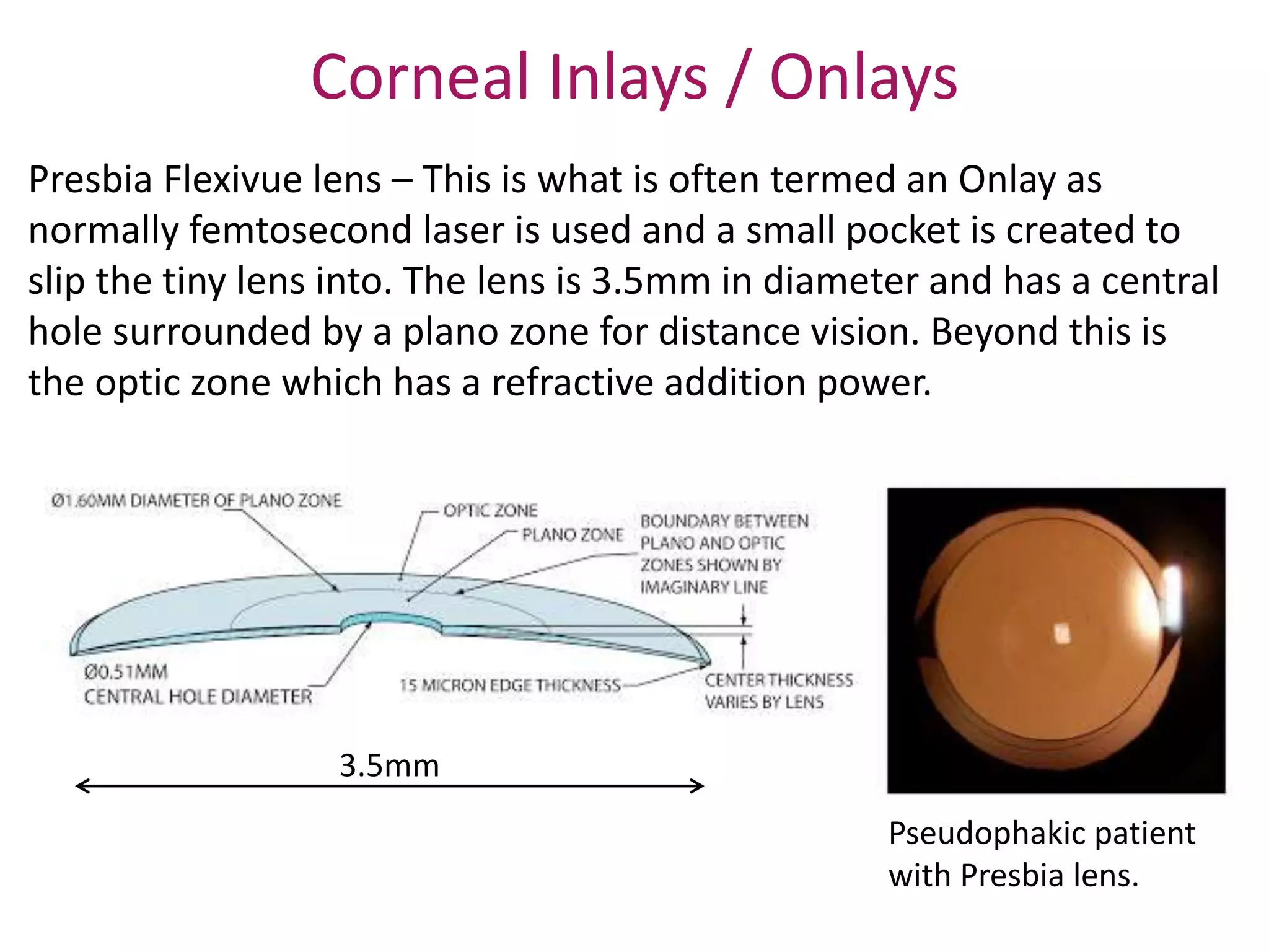 Correcting presbyopia - Modern Options | PPTX