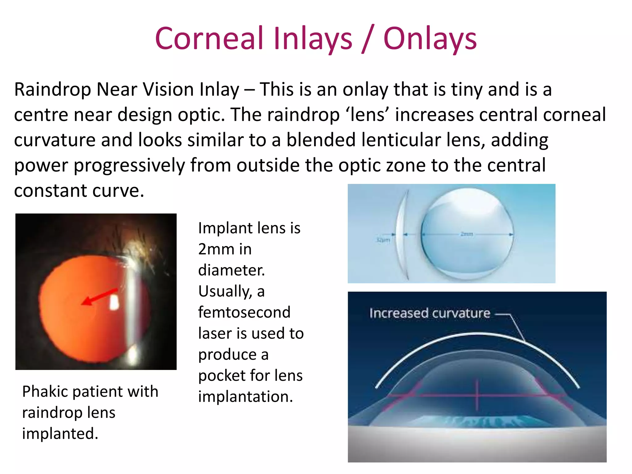 Correcting presbyopia - Modern Options | PPTX