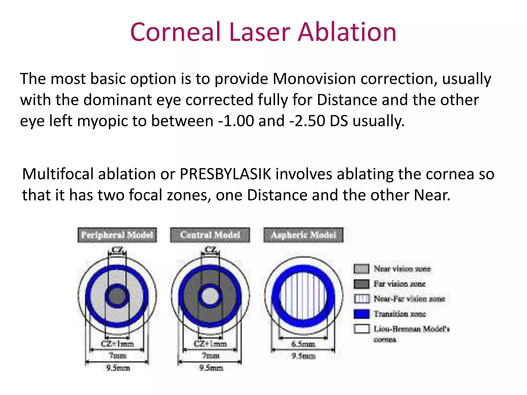 Correcting presbyopia - Modern Options | PPTX