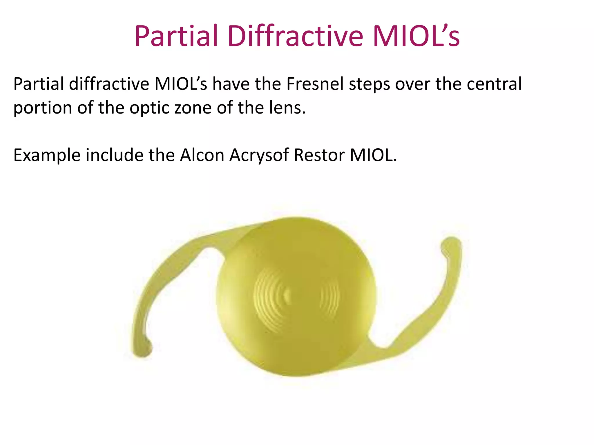 Correcting presbyopia - Modern Options | PPTX