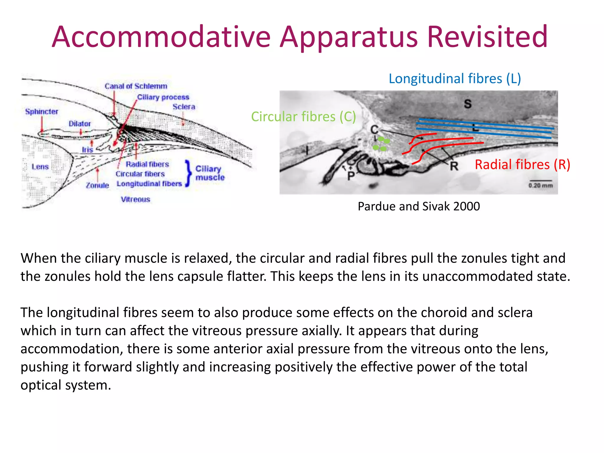 Correcting presbyopia - Modern Options | PPTX