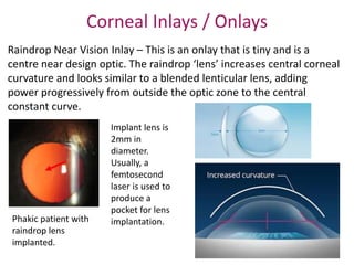 Correcting presbyopia - Modern Options | PPTX