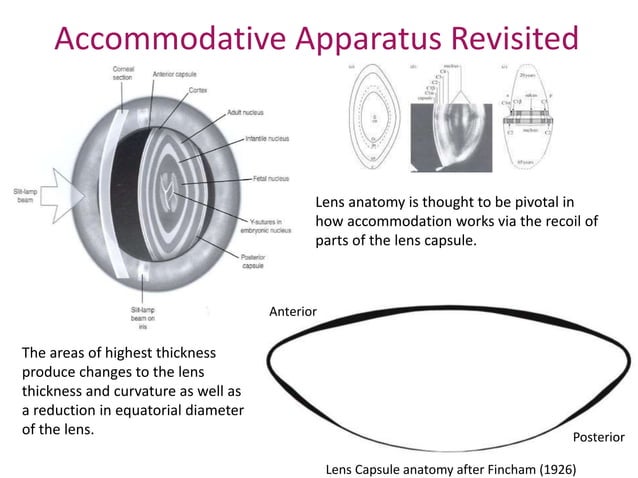 Correcting presbyopia - Modern Options | PPTX | Eye and Vision ...