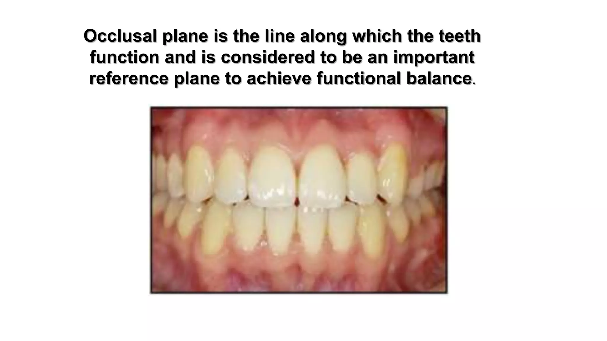 orthodontic correction of canted occlusal plane 2 | PPTX
