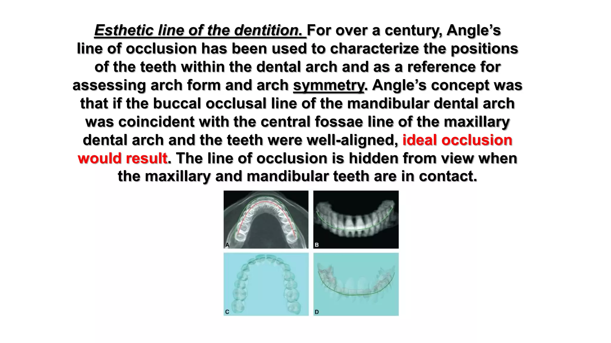 orthodontic correction of canted occlusal plane 2 | PPTX