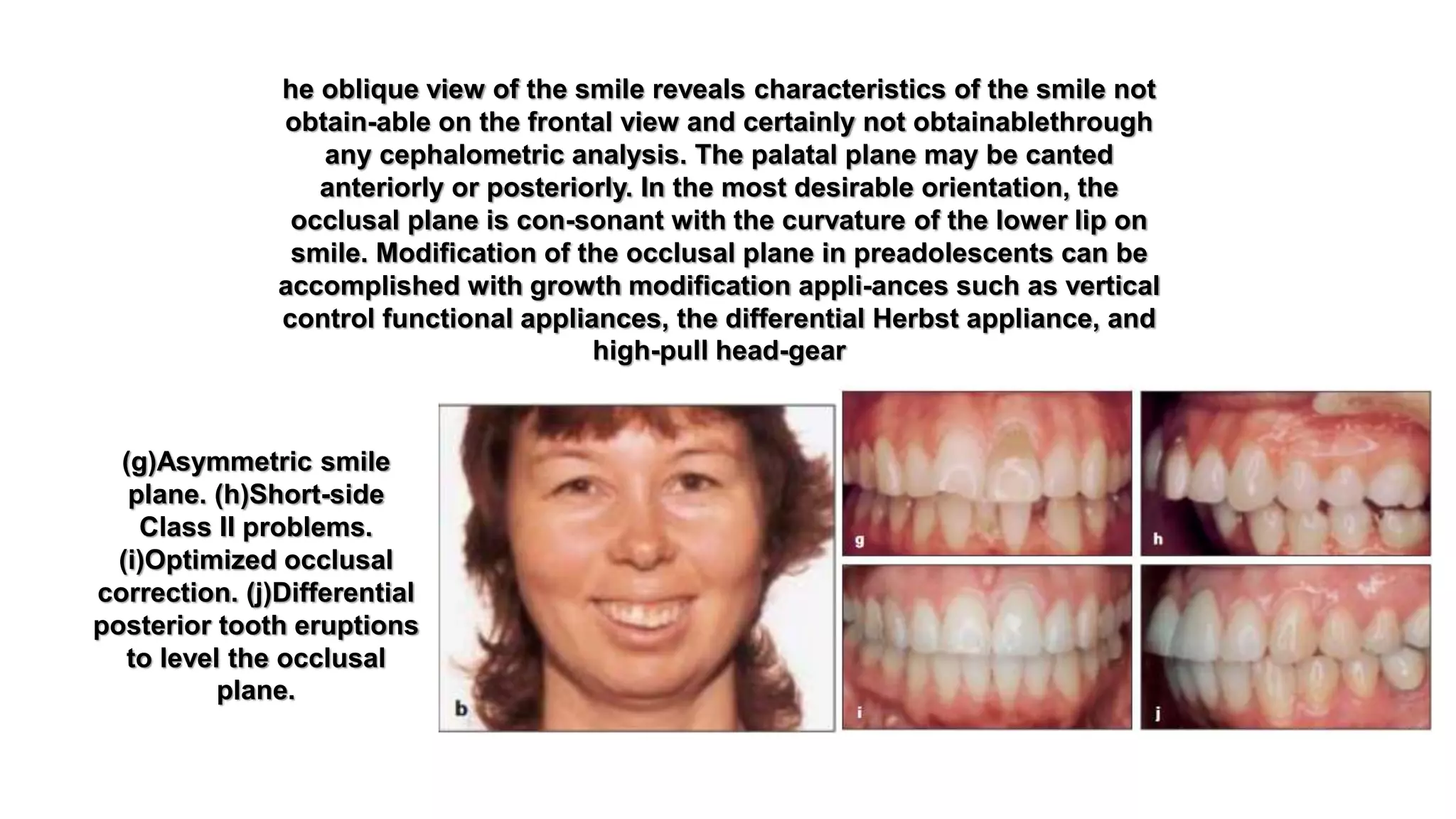 orthodontic correction of canted occlusal plane 2 | PPTX