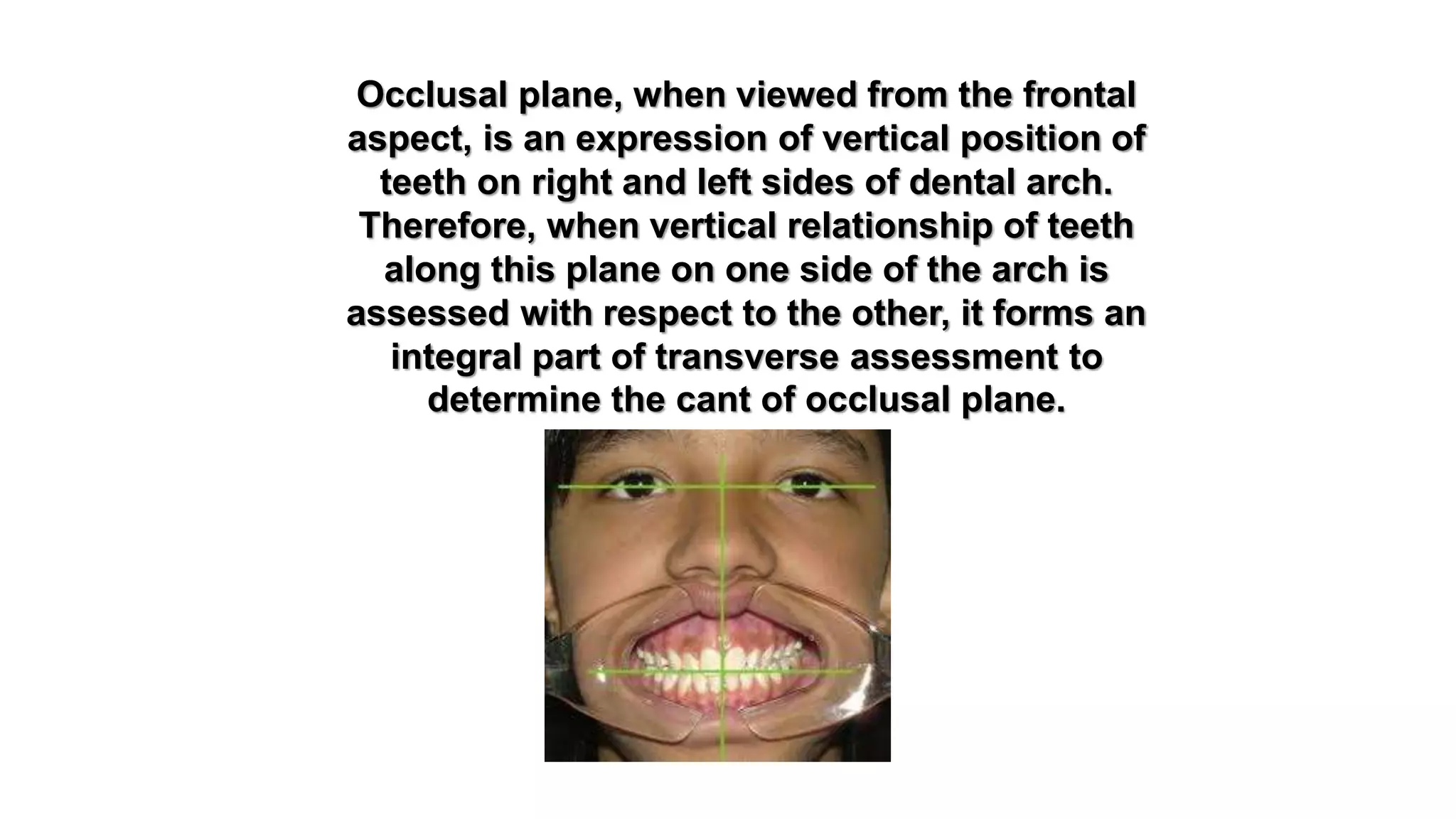 orthodontic correction of canted occlusal plane 2 | PPTX