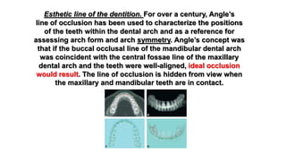 orthodontic correction of canted occlusal plane 2 | PPTX