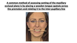 orthodontic correction of canted occlusal plane 2 | PPT