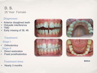 Correction of crowding teeth in adults. FDI Annual World Dental ...