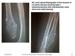 Correction of deformity of forearm. | PPT