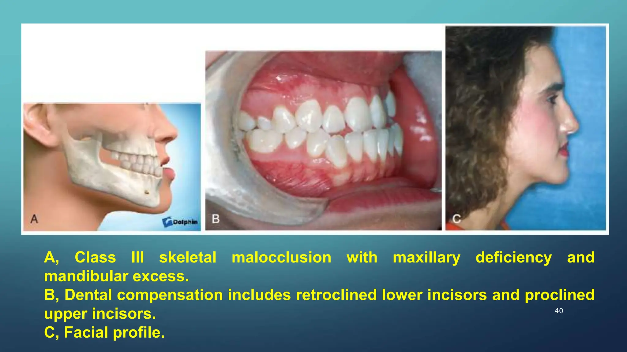 Correctionofdentofacial deformities.pptx