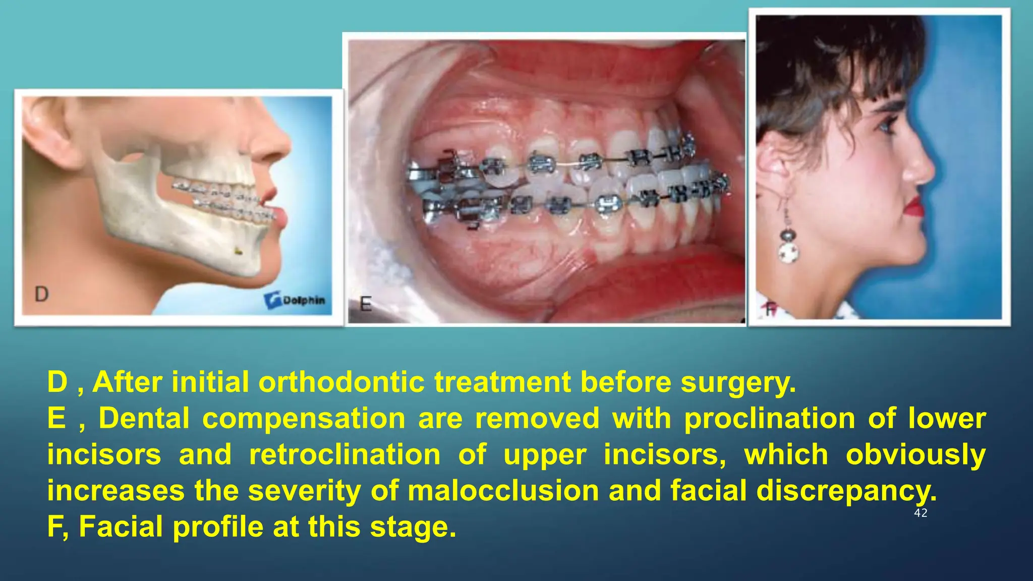 Correctionofdentofacial deformities.pptx