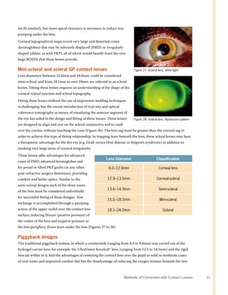 Correction of Keratoconus with GP Lenses | PDF