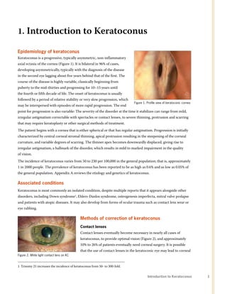 Correction of Keratoconus with GP Lenses | PDF