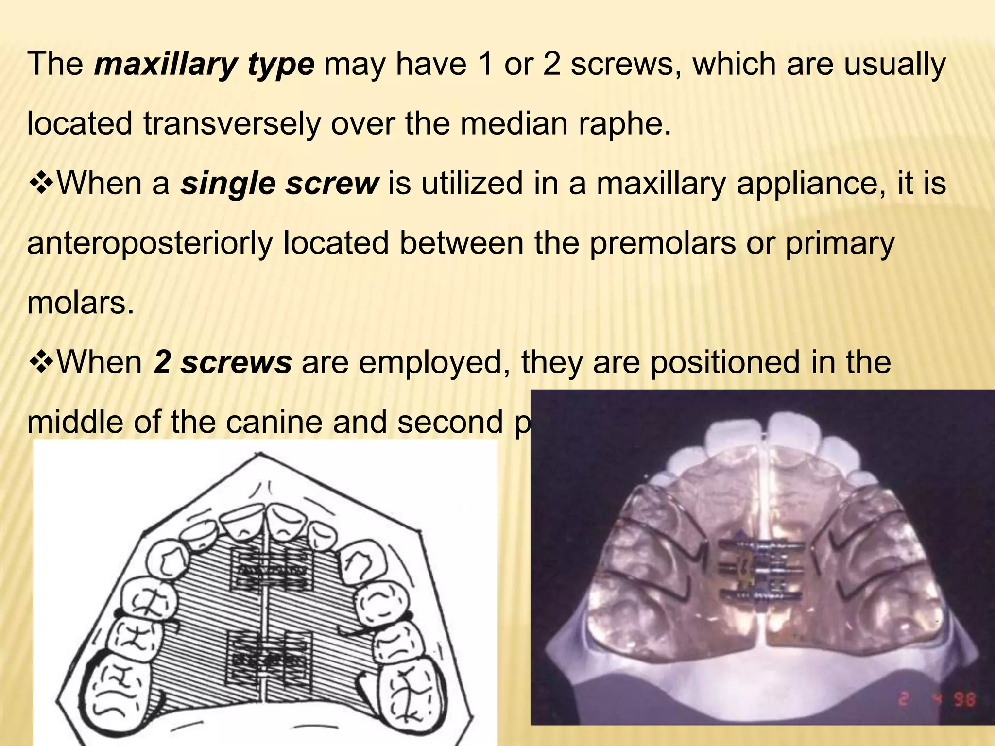 Correction of posterior crossbites | PPTX