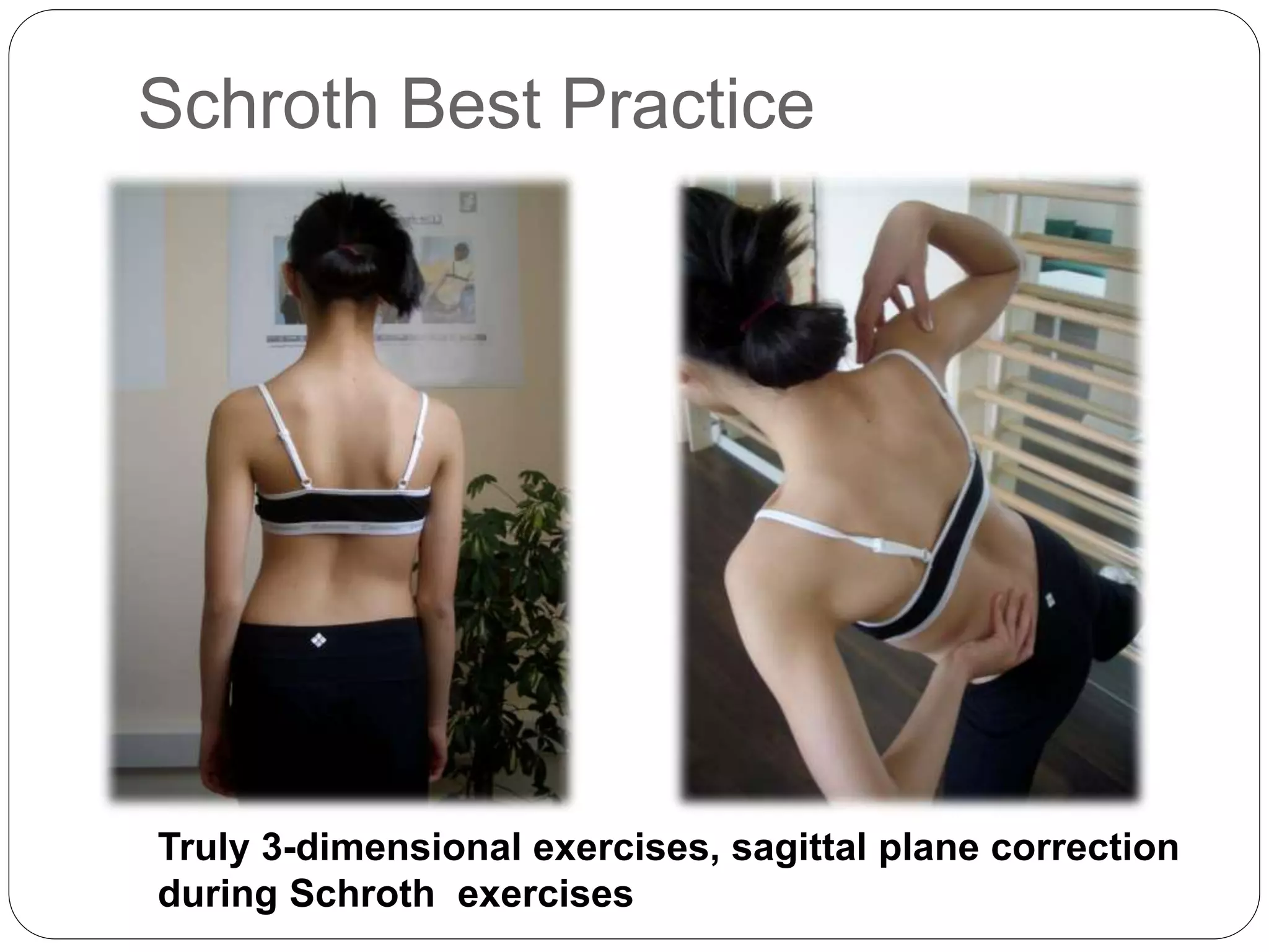 Corrective exercises in the treatment of scoliosis | PPTX