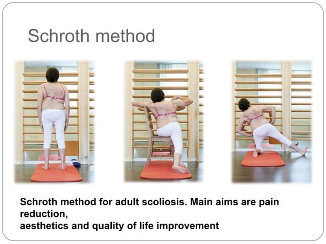 Corrective exercises in the treatment of scoliosis | PPTX