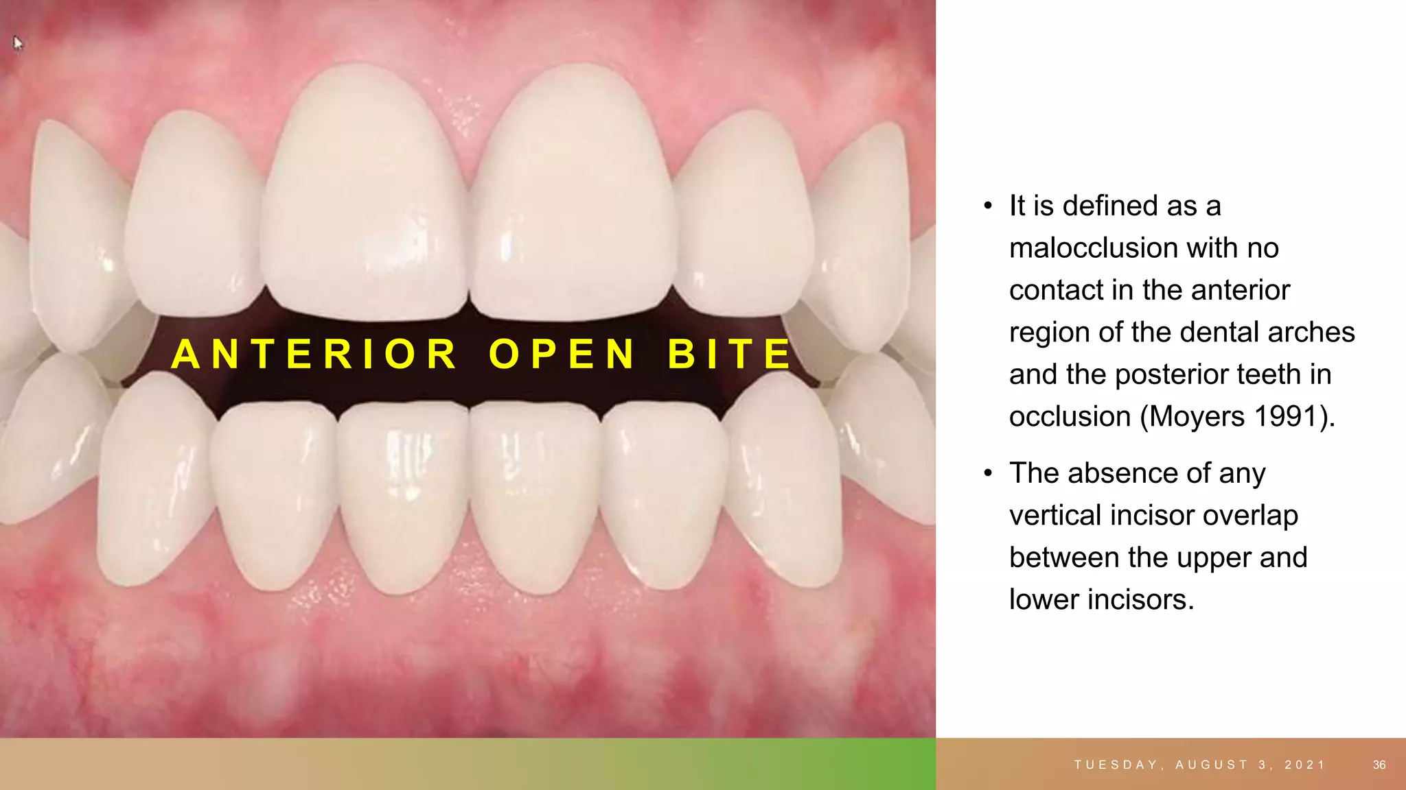 Corrective orthodontics- deep bite & open bite | PPTX