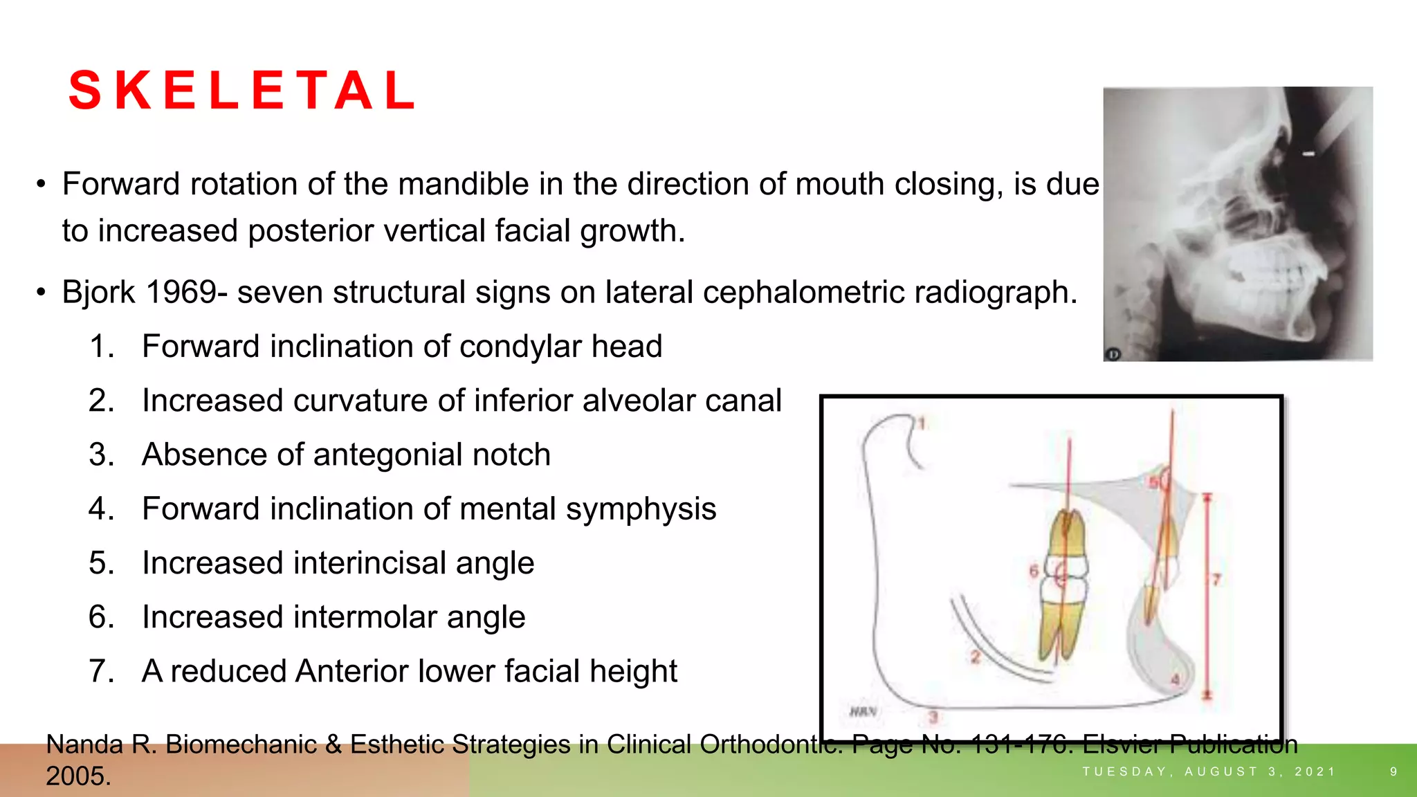 Corrective orthodontics- deep bite & open bite | PPTX