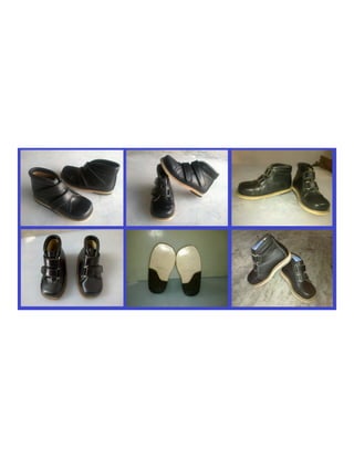 Corrective shoes pdf | PDF | Foot Health | Diseases and Conditions