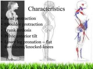Correct your posture | PPTX