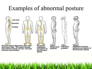Correct your posture | PPTX