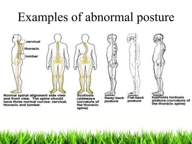 Correct your posture | PPTX