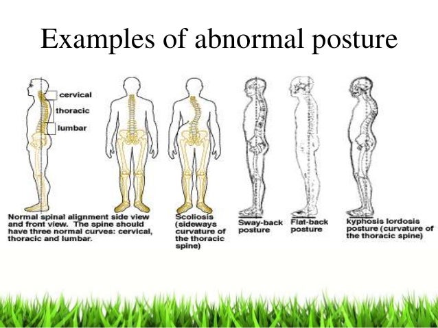 Correct your posture