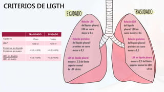 DERRAME PLEURAL.pptx