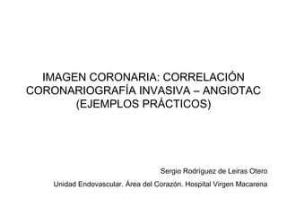Correlacion angiotac y coro invasiva hospital virgen macarena | PPT