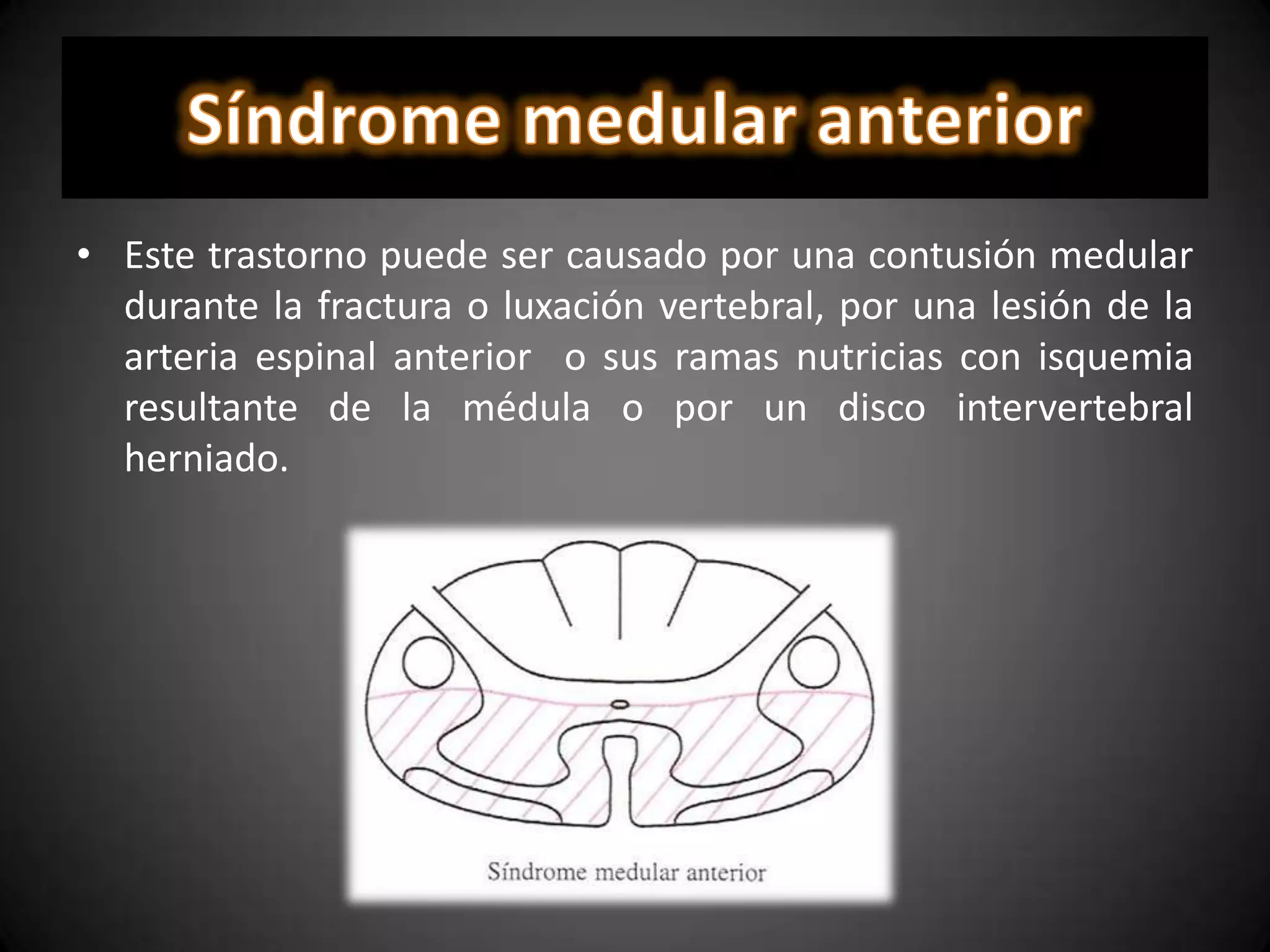 medula espinal, neuroanatomia casos clinicos | PPTX
